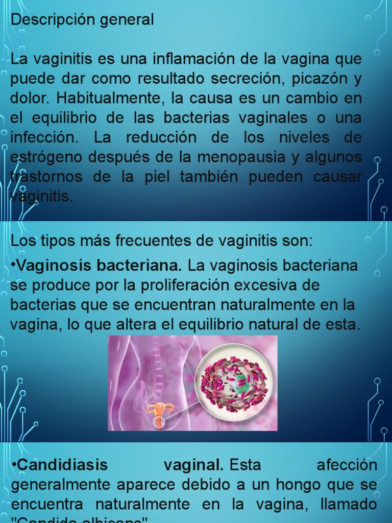 VAGINITIS | PDF
