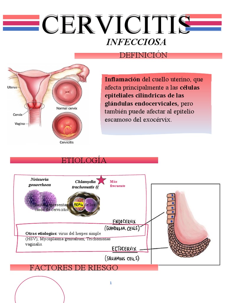 Cervicitis: Causas, Síntomas y Tratamiento | PDF | Especialidades ...