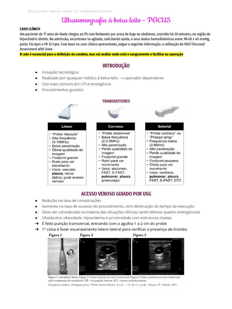 Ultrassonografia À Beira Leito - POCUS | PDF | Ultrassom médico | Especialidades médicas