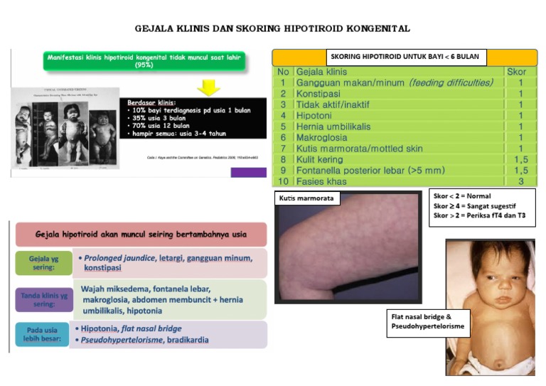 Gejala Klinis Dan Skoring Hipotiroid Kongenital | PDF