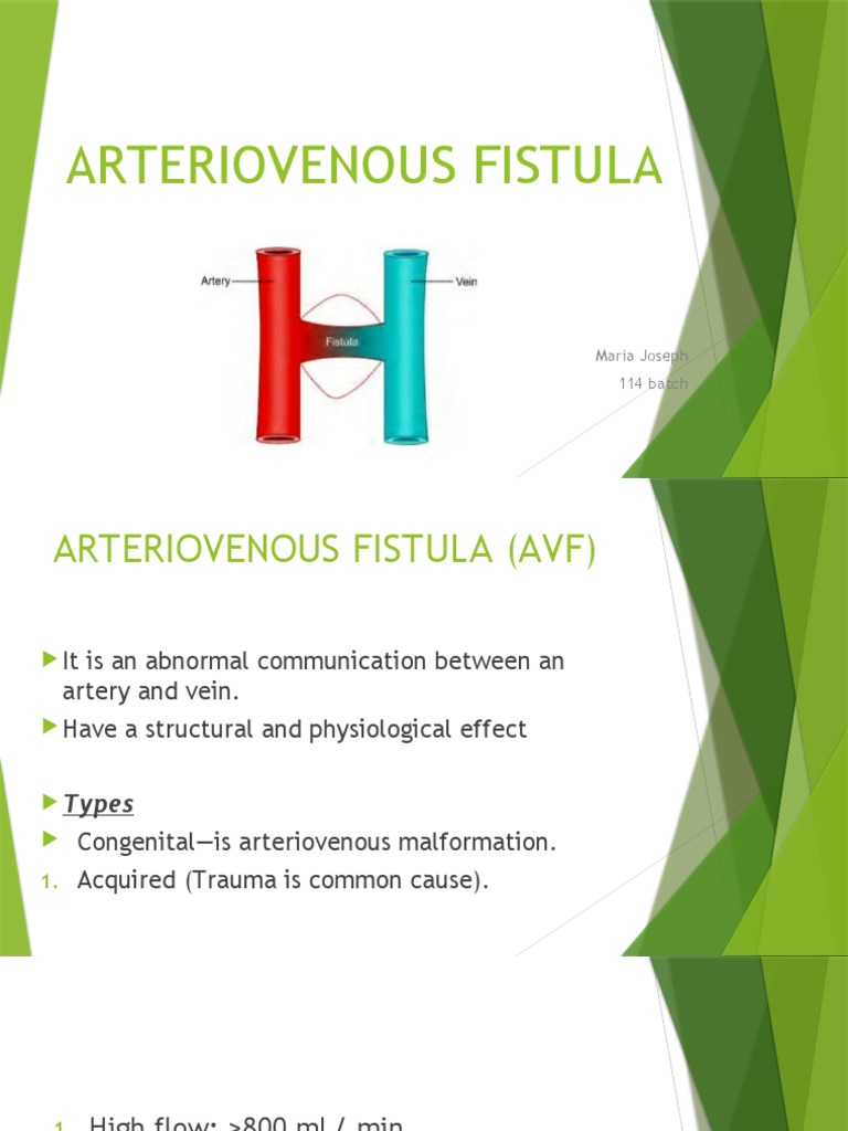 29) Arteriovenous Fistula | PDF | Vein | Cardiovascular Diseases