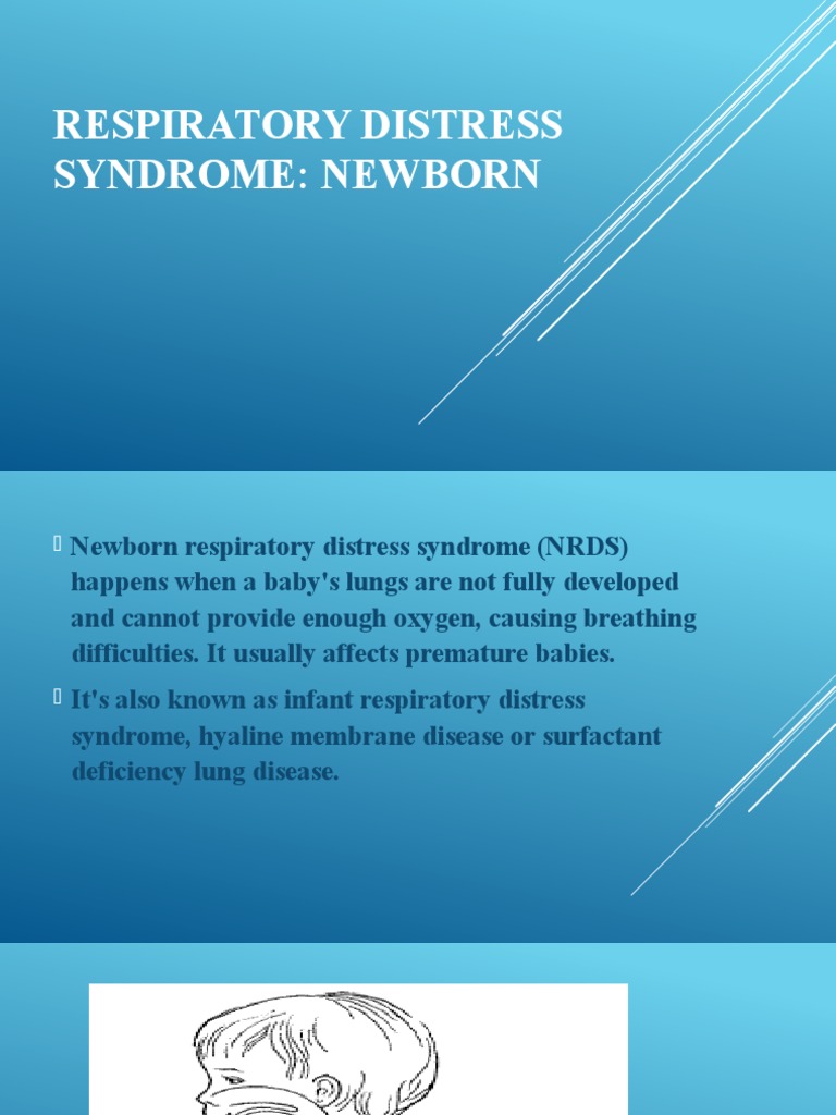 Respiratory Distress Syndrome: Newborn | PDF | Preterm Birth | Medical ...