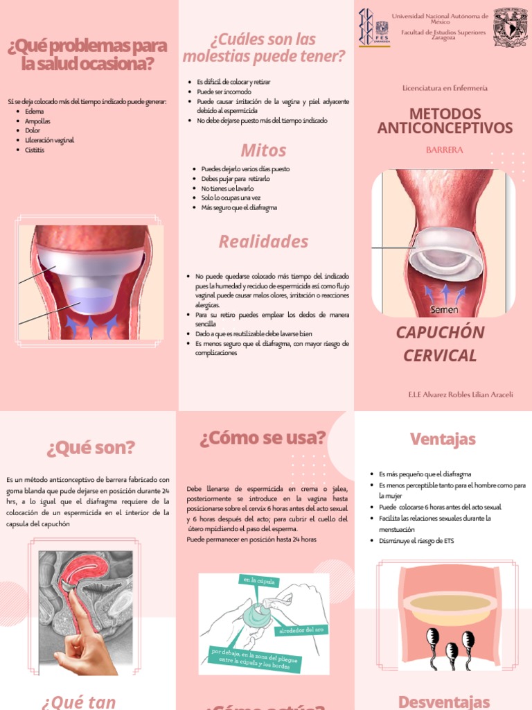 Folleto Capuchón Cervical | PDF | Vagina | Control de la natalidad