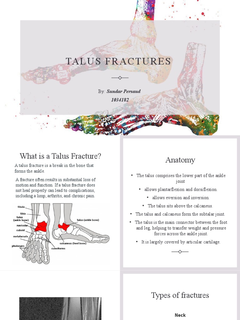 Talus Fractures | PDF | Ankle | Injury