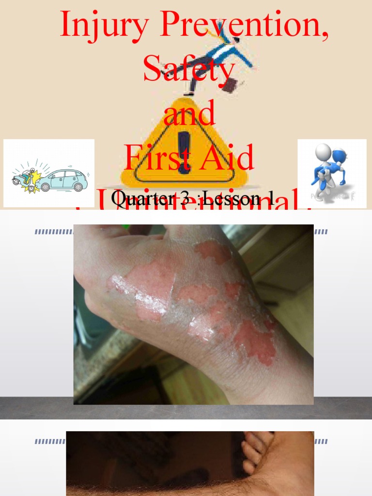 QUARTER 1. Lesson 1. Injury Prevention | PDF