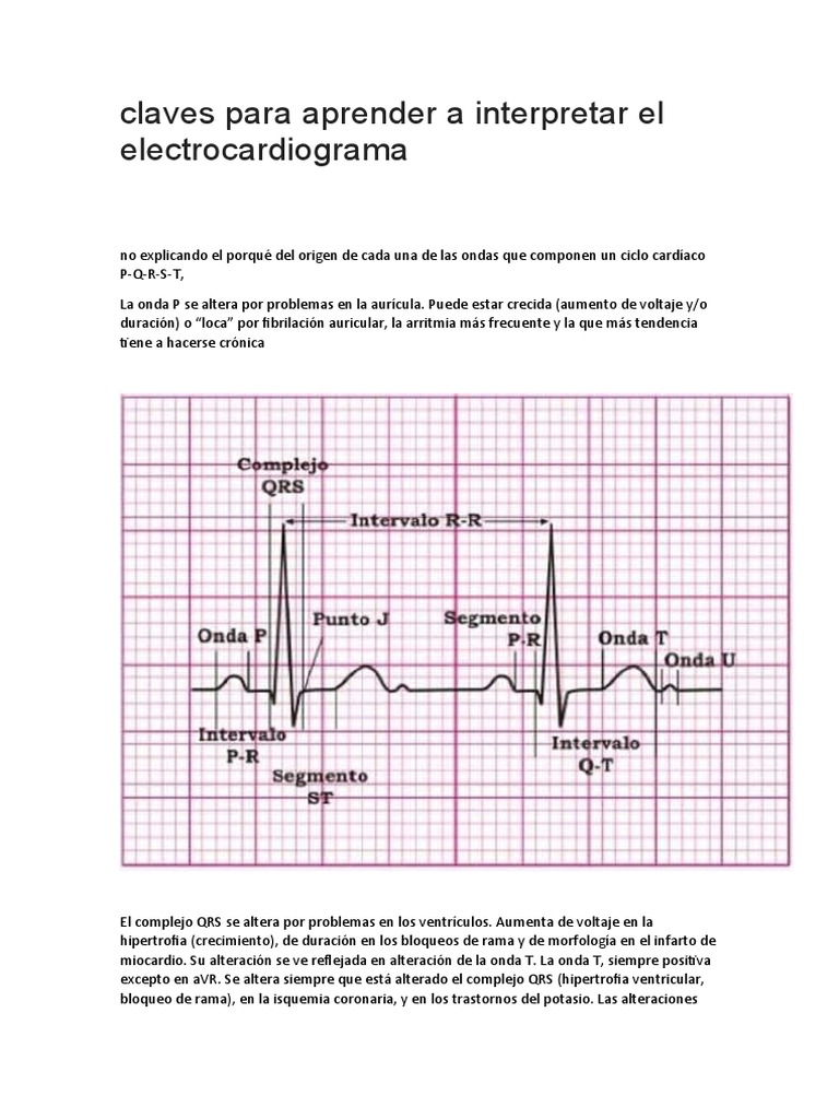 Interpretación Del Electrocardiograma Pdf Ciencia Y Matemáticas
