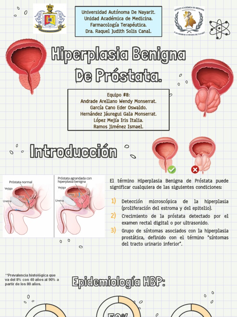 Hiperplasia Benigna de Próstata | PDF | Cancer de prostata | Medicina ...