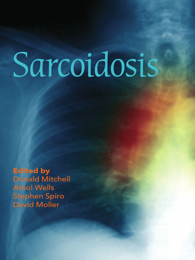 Sarcoidosis by Donald Mitchell (Editor) Athol Wells (Editor) Stephen ...
