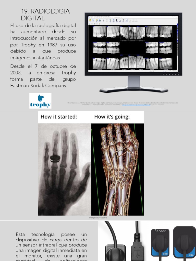Tema 19. Radiologia Digital | PDF | Rayo X | Radiología