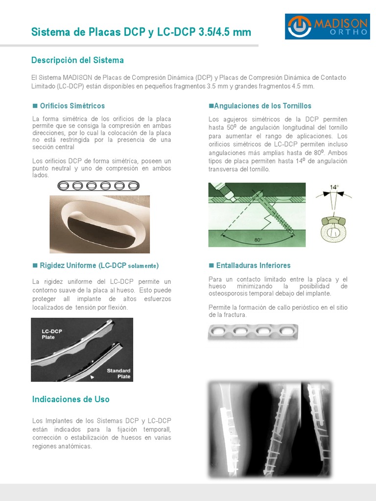 DCP and LC DCP System ES1 | PDF | Tornillo | Ingeniería de Edificación