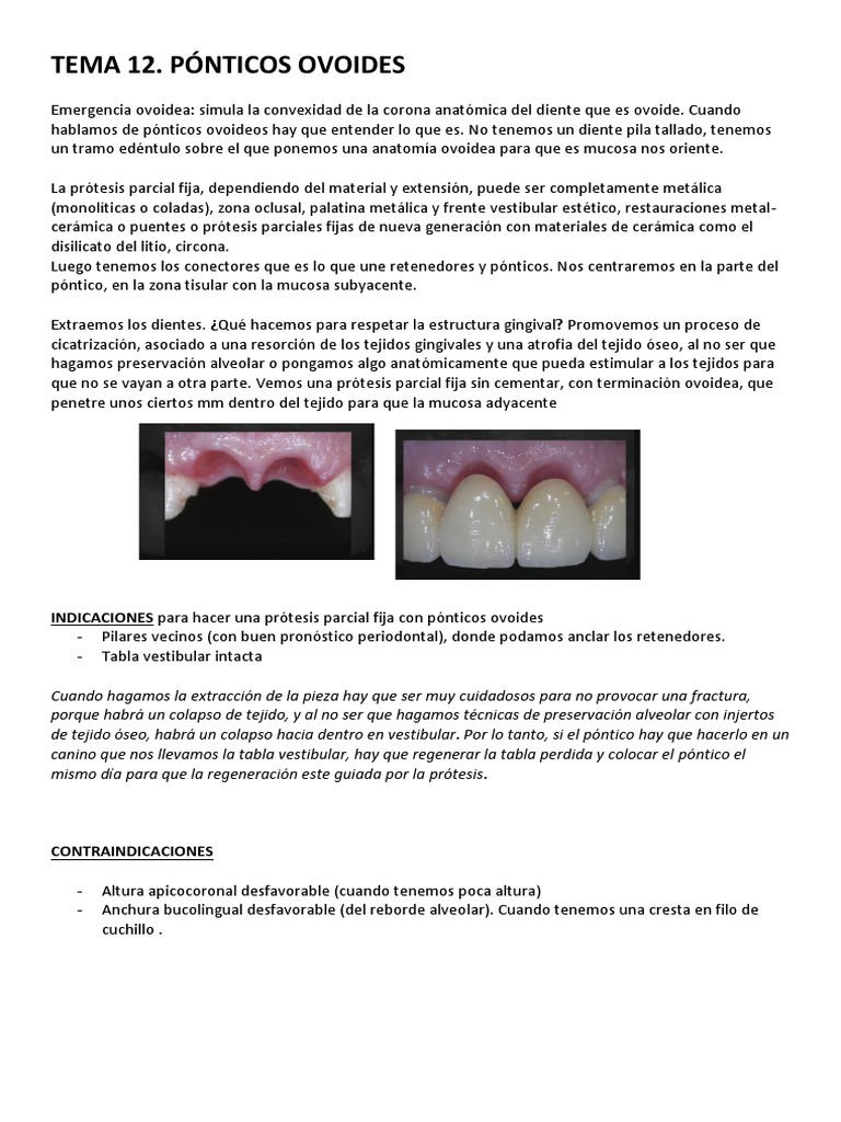 TEMA 12 PROT Color PDF | PDF | Dentadura postiza | Medicina CLINICA