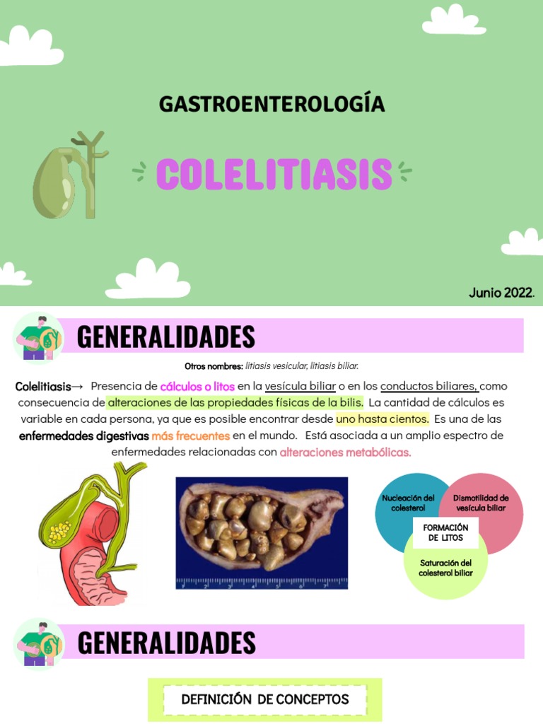 Colelitiasis y Sus Complicaciones | PDF | Vesícula biliar | Sistema ...