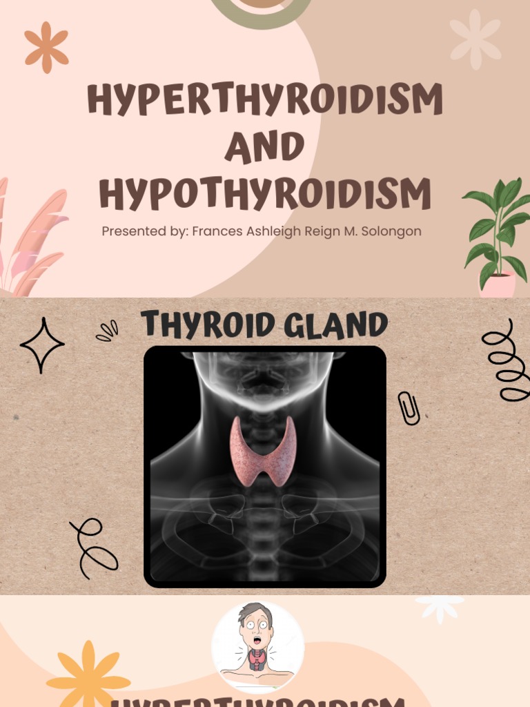 Hyperthyroidism and Hypothyroidism | PDF | Hyperthyroidism | Hypothyroidism