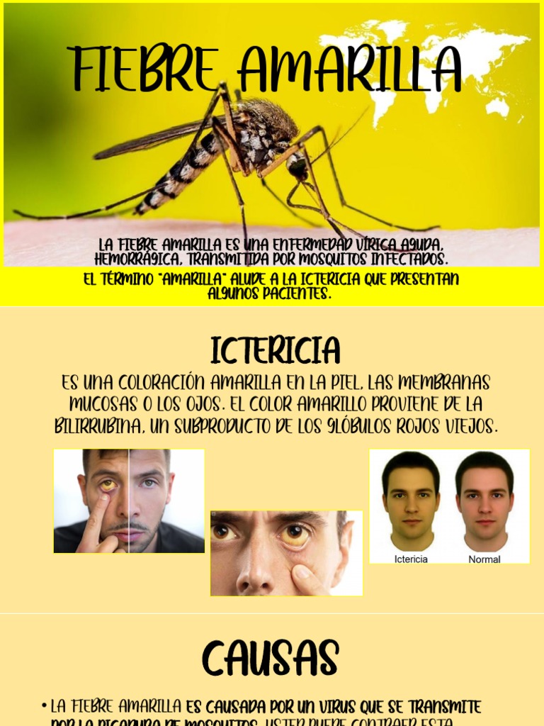 Fiebre Amarilla | PDF | Fiebre amarilla | Virus