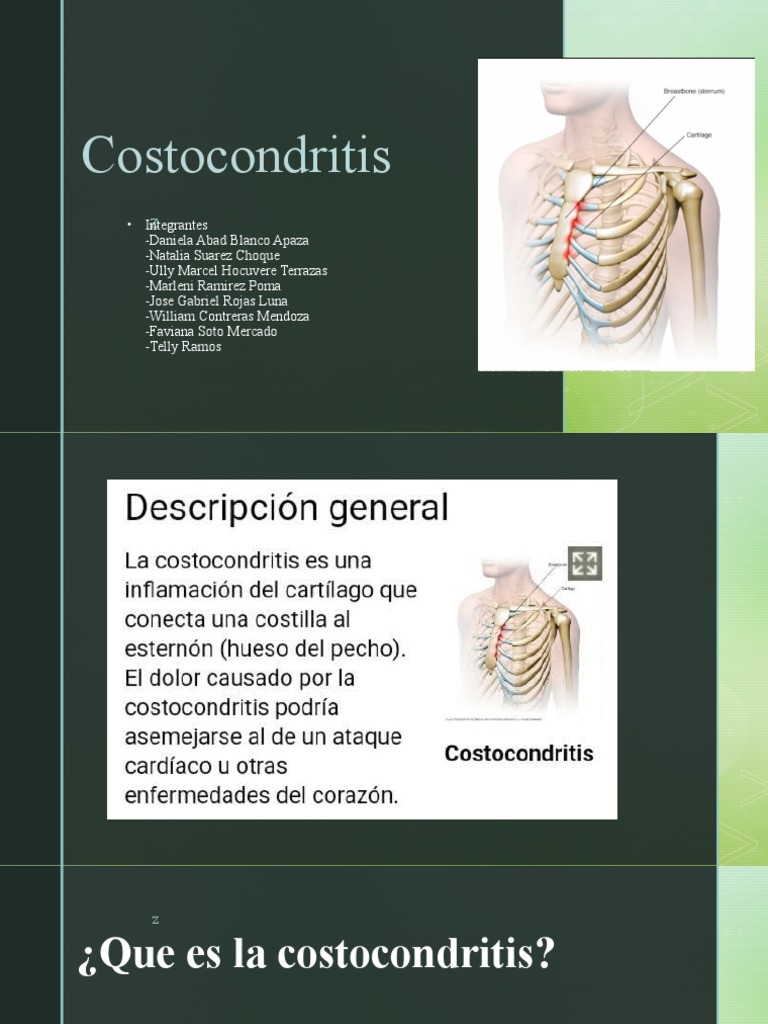 Costocondritis | PDF | Medicina CLINICA | Causas de la muerte