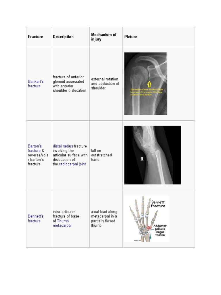 List of Fracture | Download Free PDF | Ankle | Anatomical Terms Of Motion