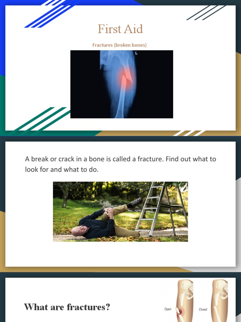 First Aid Broken Bone.pptx | PDF | Fracture | Wound