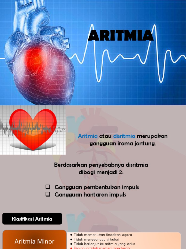 Klasifikasi dan Terapi Aritmia Jantung | PDF