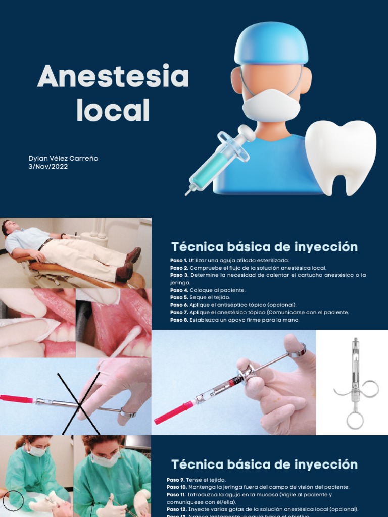 Anestesia Local PDF | PDF | Inyección (medicina) | Cabeza y cuello humanos
