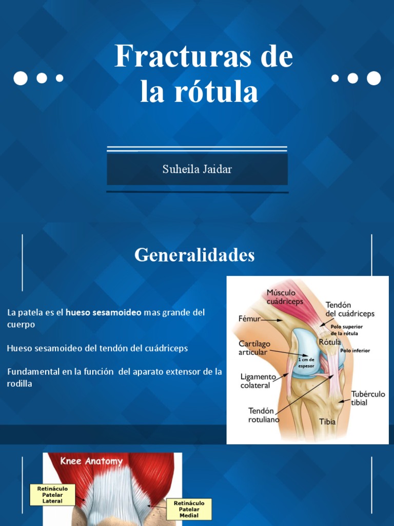 Fracturas de La Rótula | PDF | Rodilla | Anatomía humana