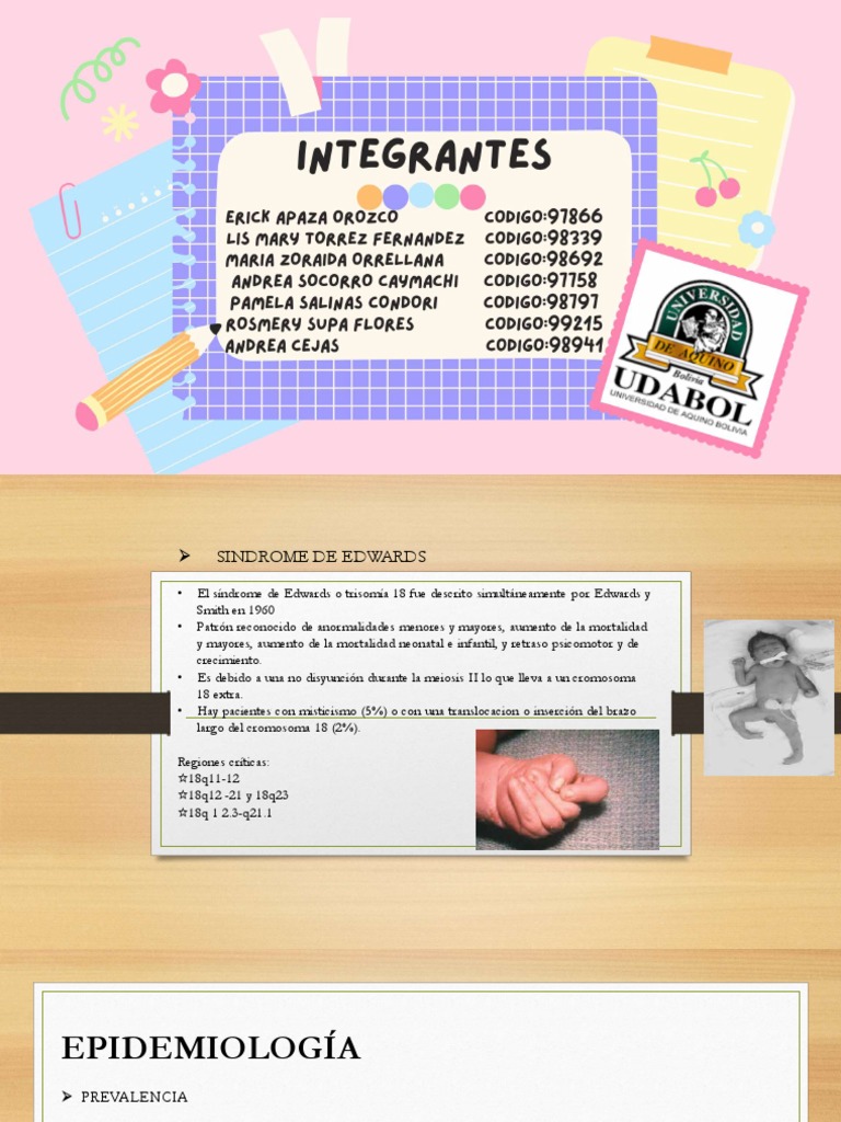 Síndrome de Edwards: Trisomía 18 y Prognóstico | PDF | Especialidades ...