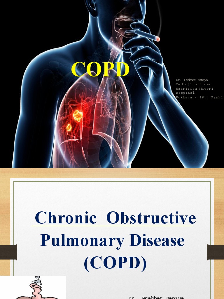 Copd | PDF | Chronic Obstructive Pulmonary Disease | Lung