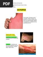 Regla de Los 9 de Wallace | PDF | Salud y bienestar | Historia