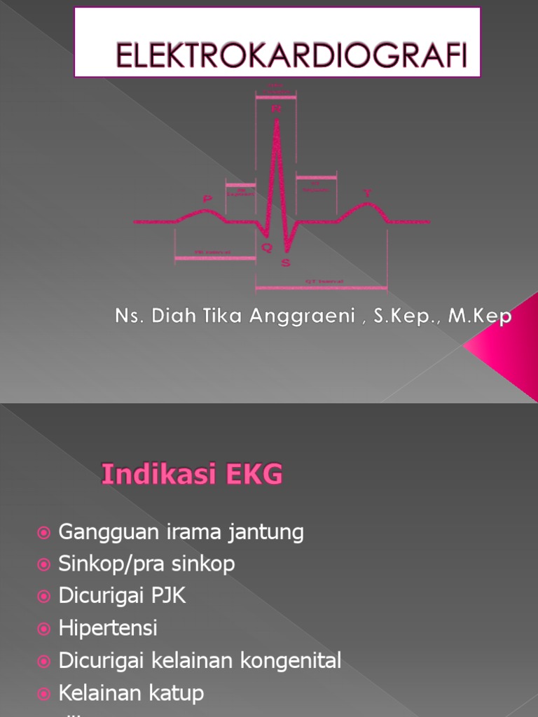 Interpretasi EKG.pdf | PDF