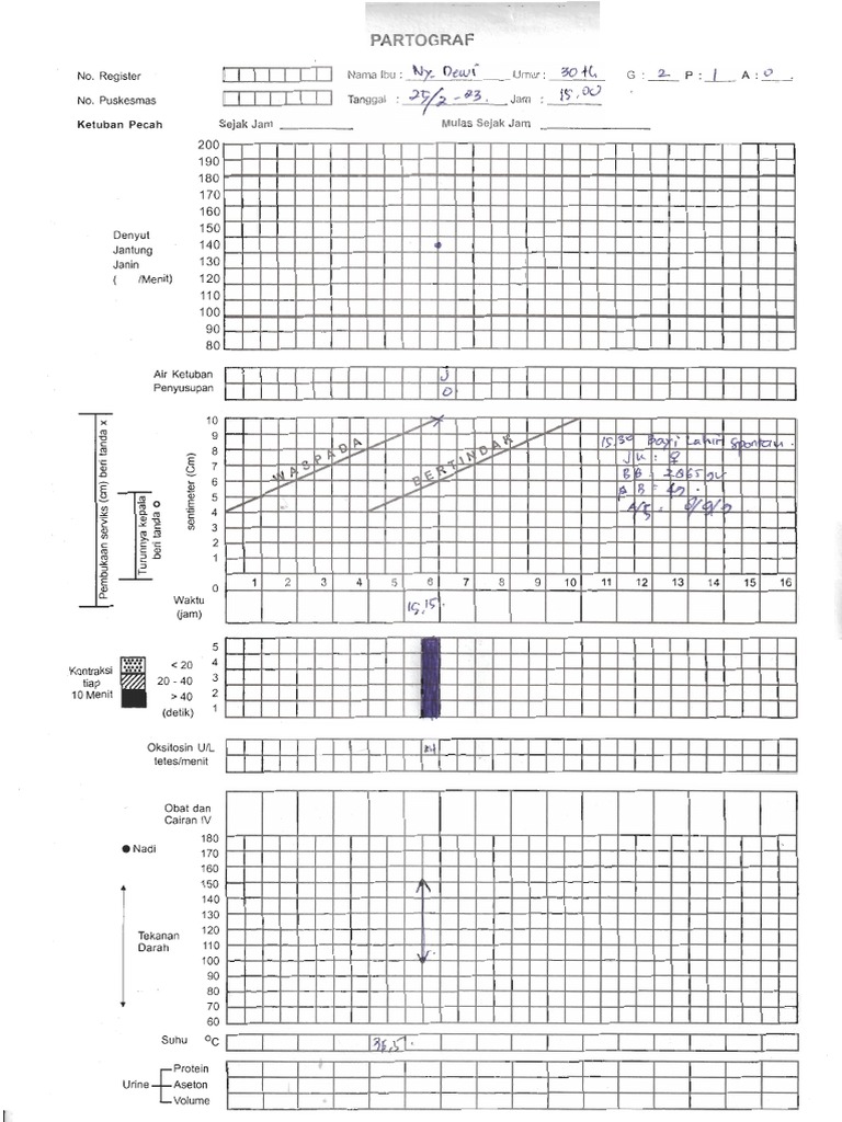 Partograf PDF | PDF