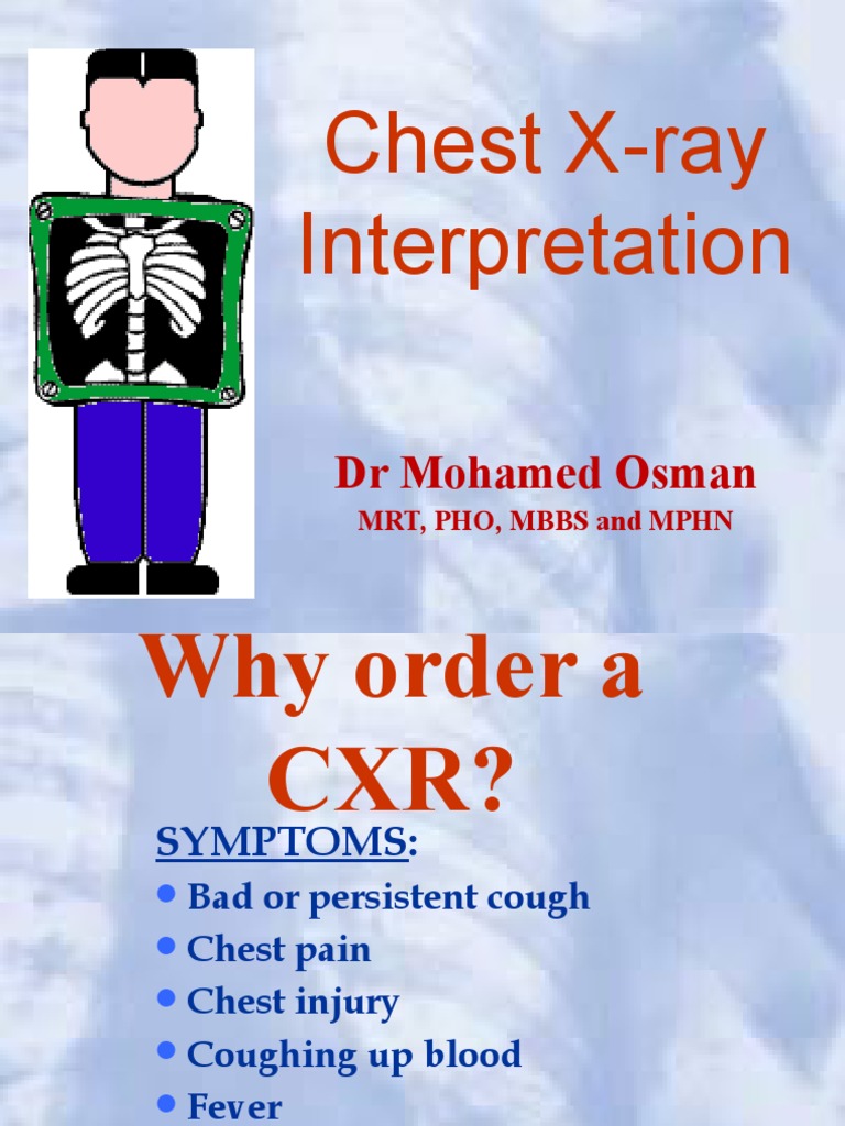 Chest X - Ray Interpretation | Download Free PDF | Lung | Thorax