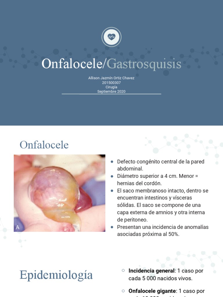 Onfalocele y Gastrosquisis | PDF | El embarazo | Especialidades Medicas