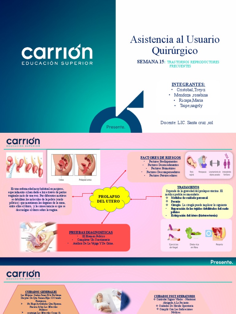 Prolapso Utero | PDF | Cirugía | Vagina