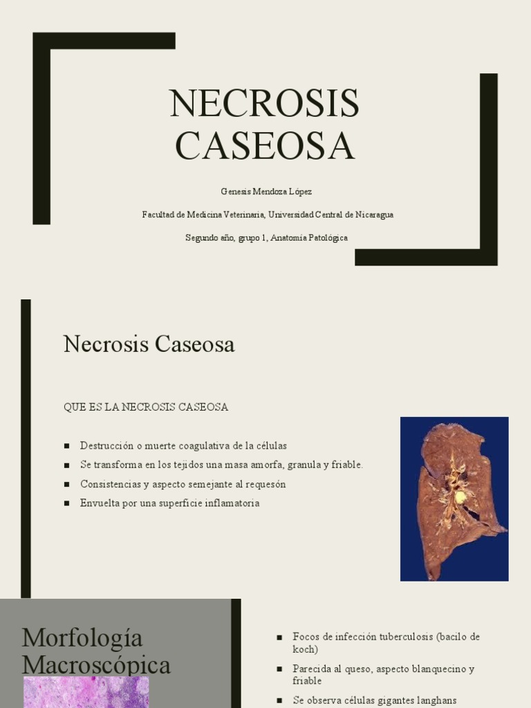 Necrosis Caseosa | PDF