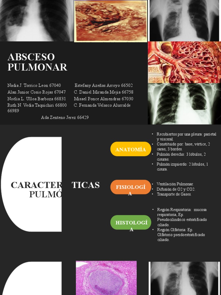 ABSCESO PULMONAR (1) | PDF | Tos | Causas de la muerte