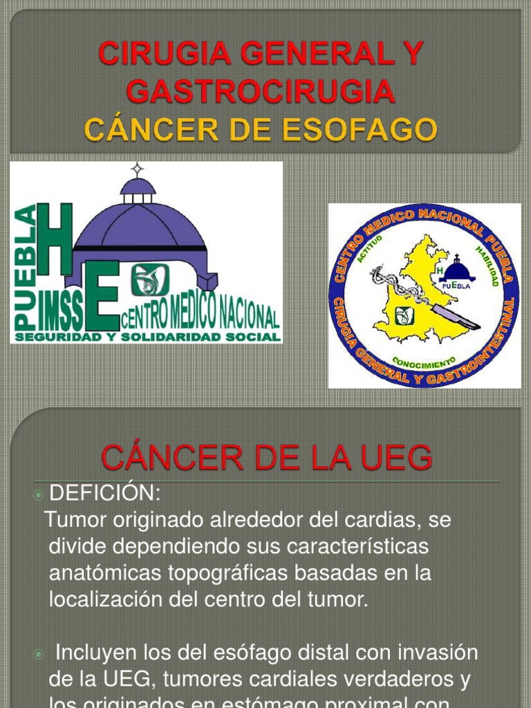 ESOFAG | PDF | La enfermedad por reflujo gastroesofágico | Cáncer