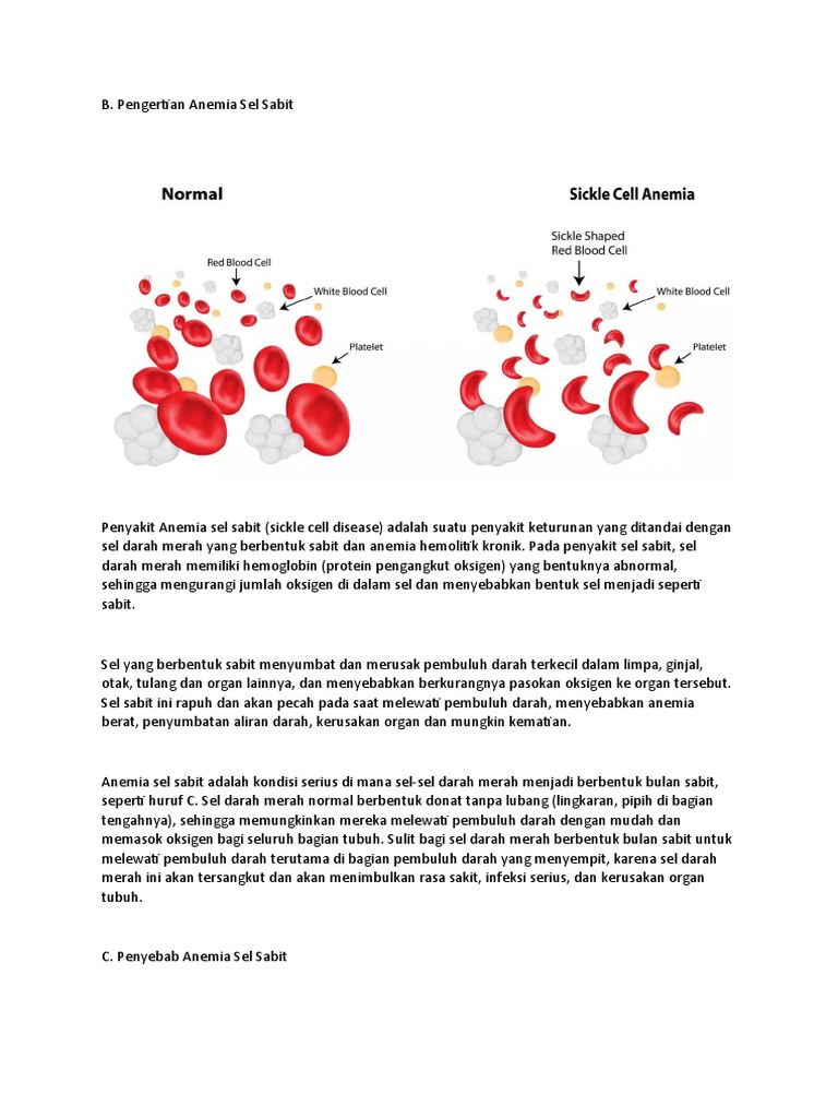 Anemia Sel Sabit | PDF
