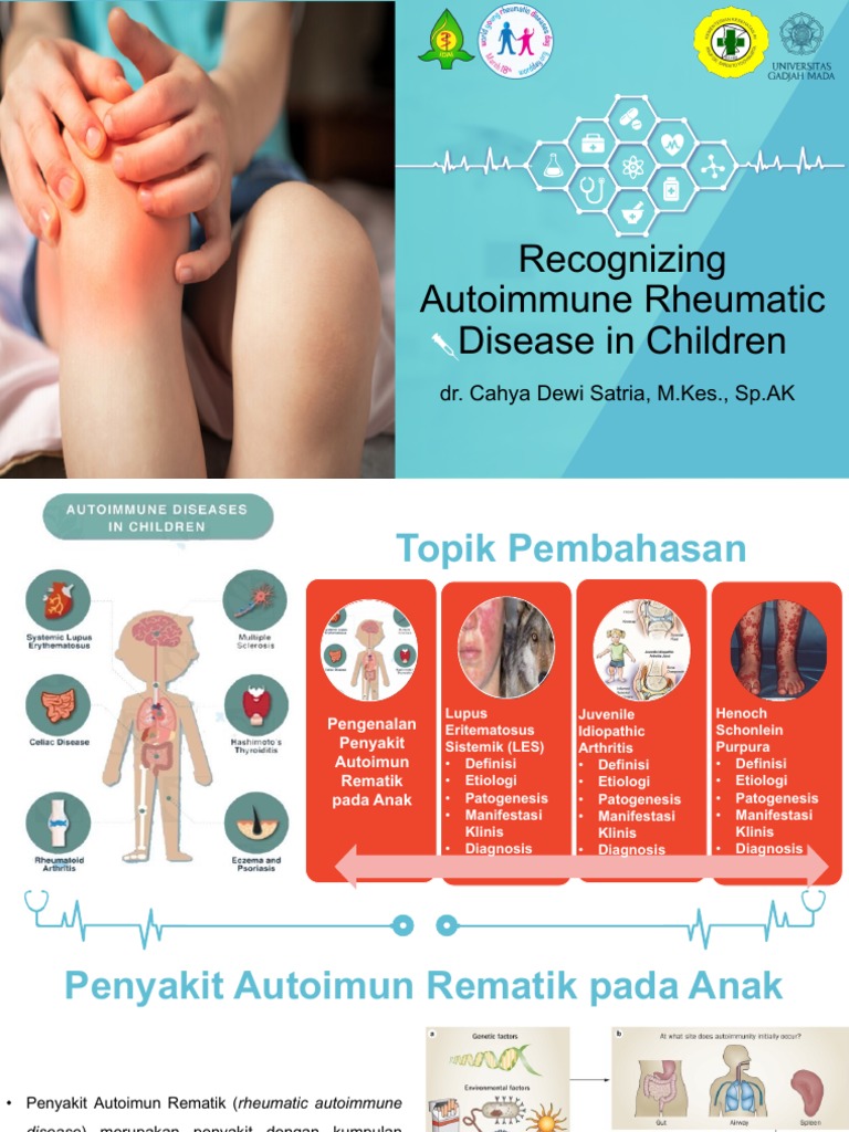 FINAL - CDS - Recognizing Autoimmune Rheumatic Disease in Children ...