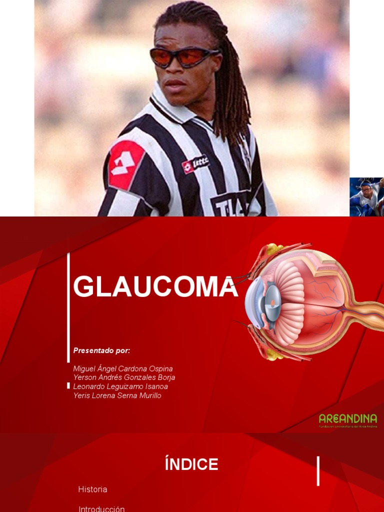 Glaucoma Final | PDF | Glaucoma | Sistema visual