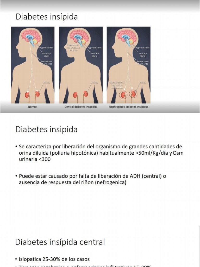 Diabetes Insipida y SIADH | PDF
