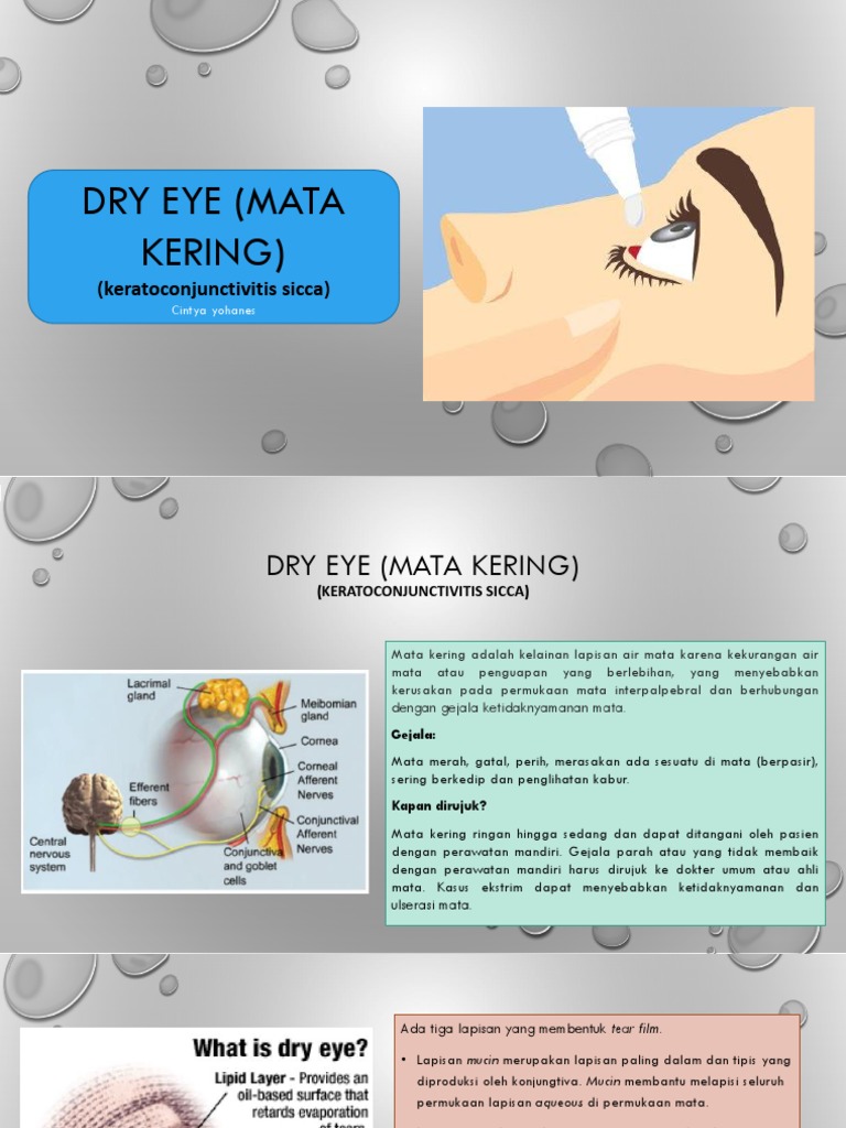 Dry Eye PDF | PDF