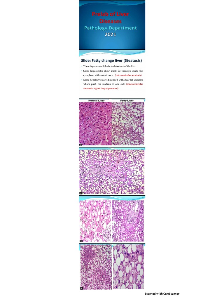 Practicle Pathology GIT PDF | PDF