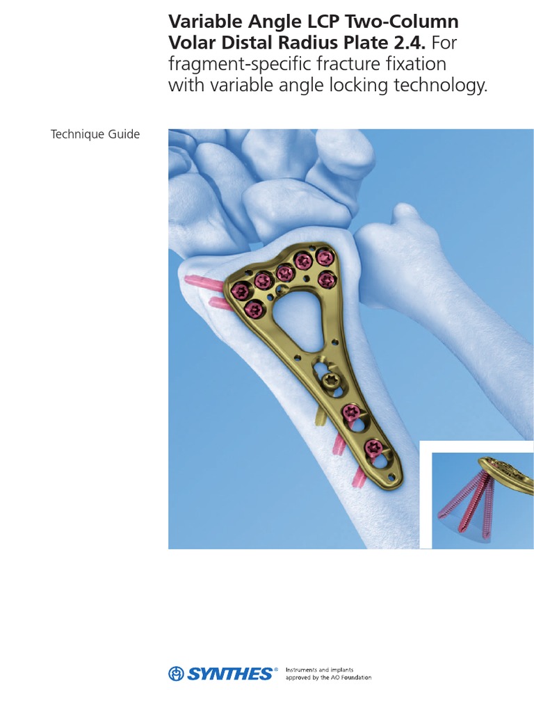 VA LCP Two Column Distal Radius Plate 2.4mm PDF | PDF | Musculoskeletal ...