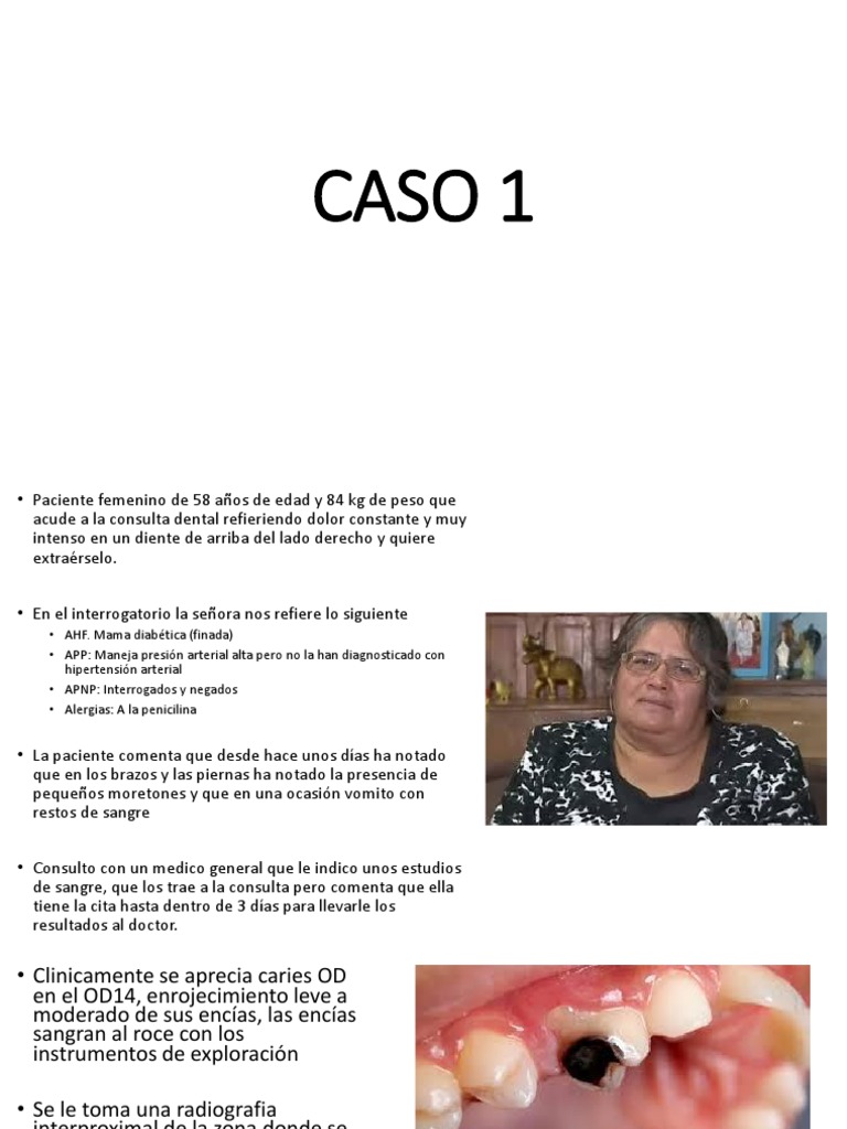 Caso 1 CX | PDF