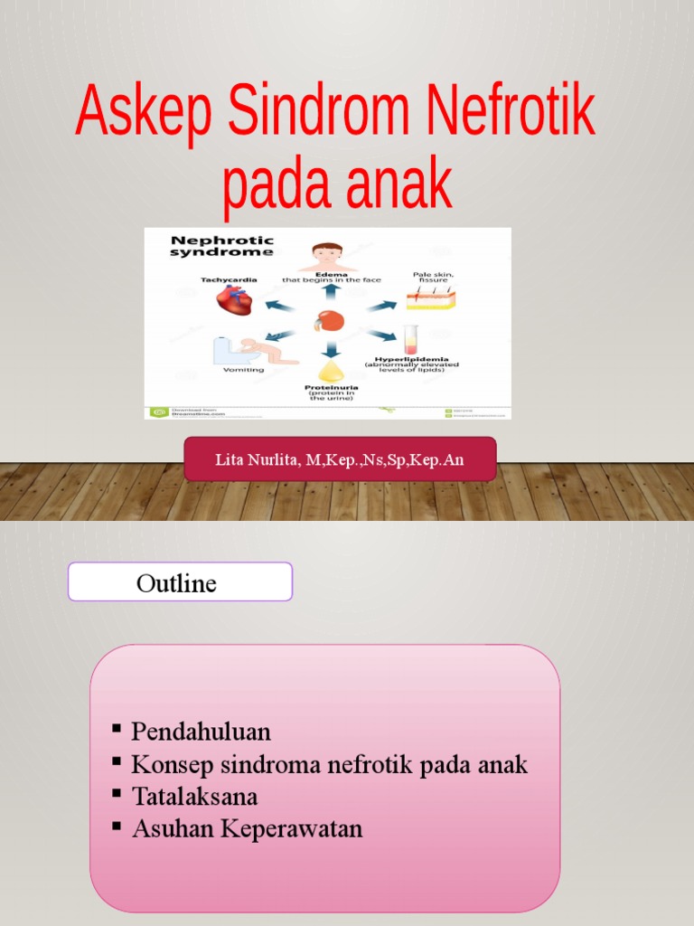 Askep Sindrome Nefrotik Fix | PDF | Gaya Hidup