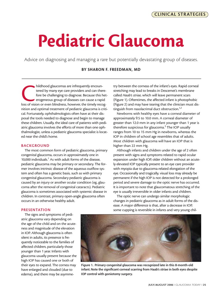 Pediatric Glaucoma: Advice On Diagnosing and Managing A Rare But ...