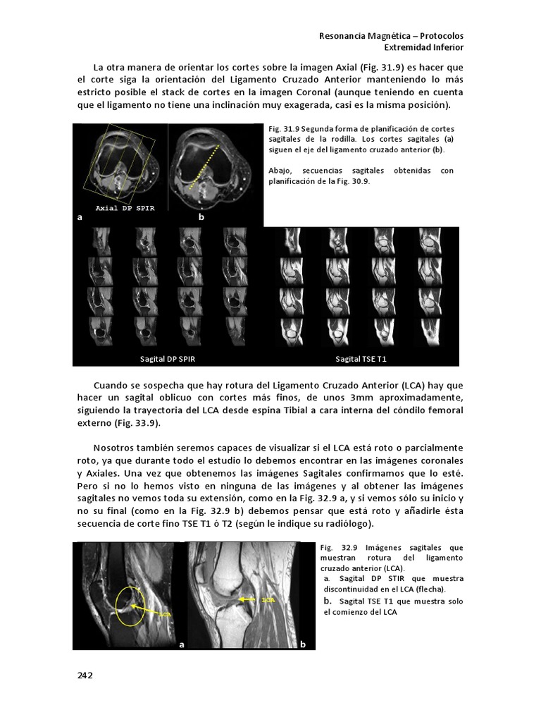 RM de Rodilla PDF | Descargar gratis PDF | Rodilla | Anatomía humana