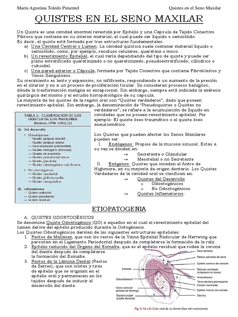 Quistes en el Seno Maxilar: Tipos y Tratamientos | PDF | Epitelio ...