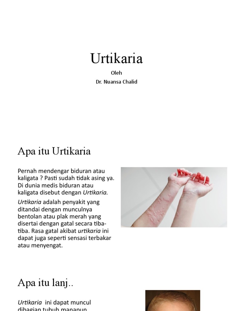 Urtikaria | PDF