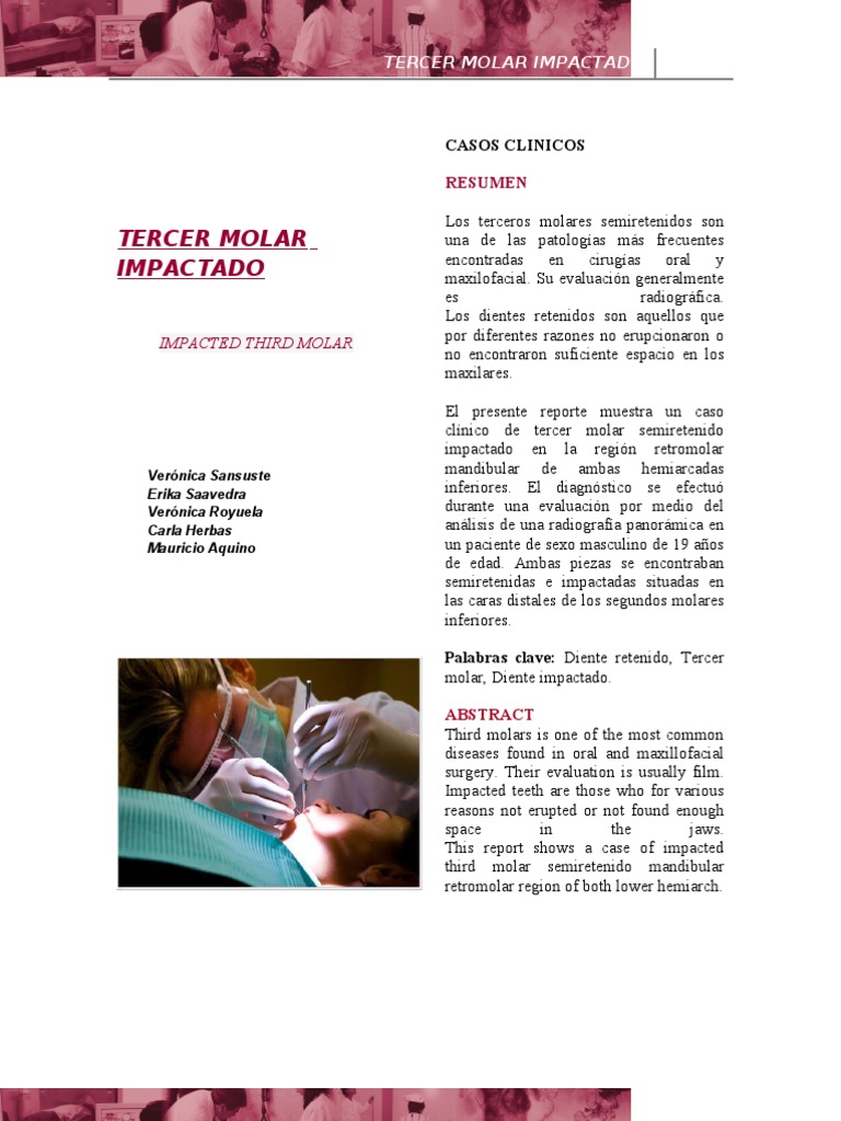 Tercer Molar Impactado | PDF | Diente humano | Odontología