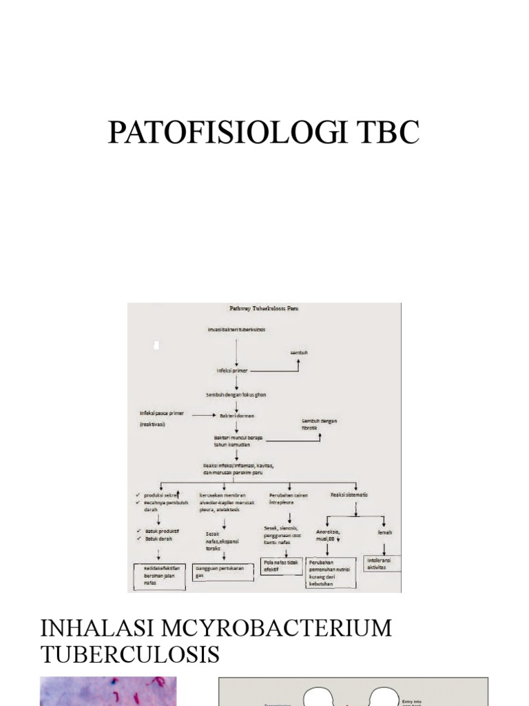 PATOFISIOLOGI TBC.pptx | PDF